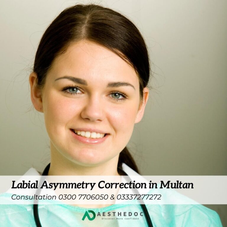 Labial Asymmetry Correction in Multan | Dr Naila Farukh